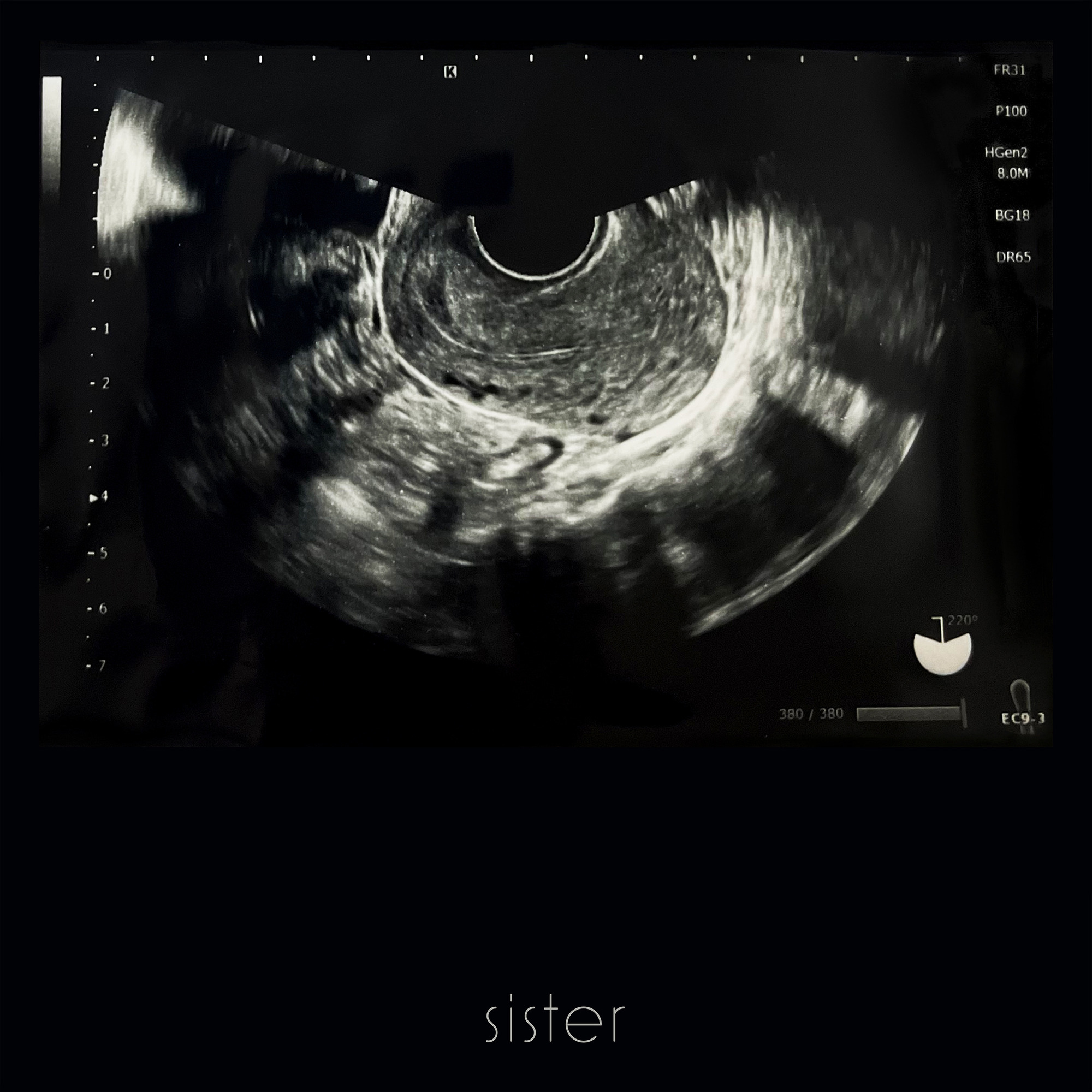 【Radio】『sister』が 各地パワープレイに決定！ | チョーキューメイ オフィシャルサイト